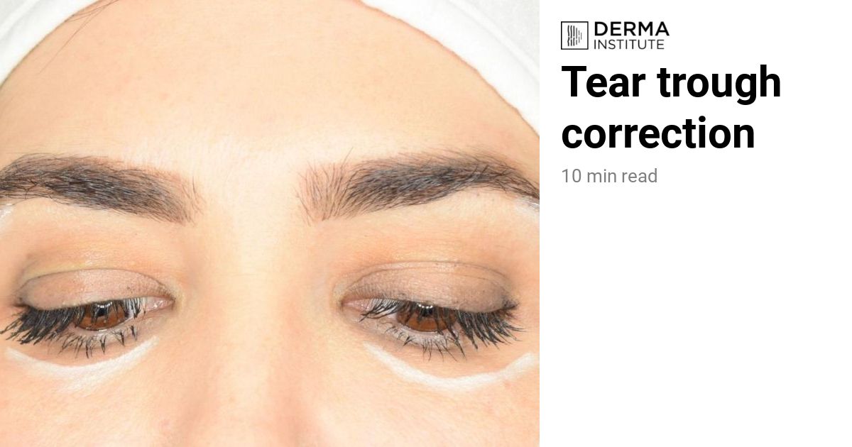 Tear trough correction | Derma Institute