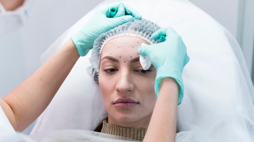 Botox for forehead | Derma Institute
